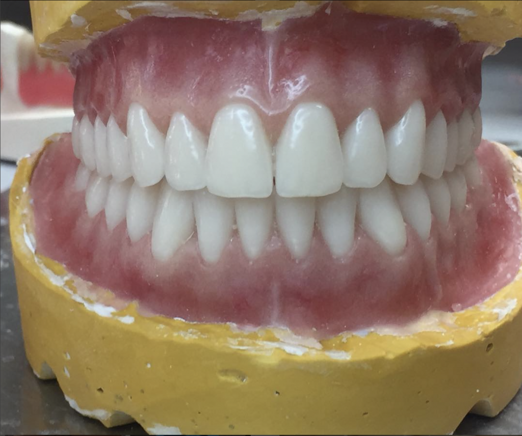 RTDL – Dentures Laboratory