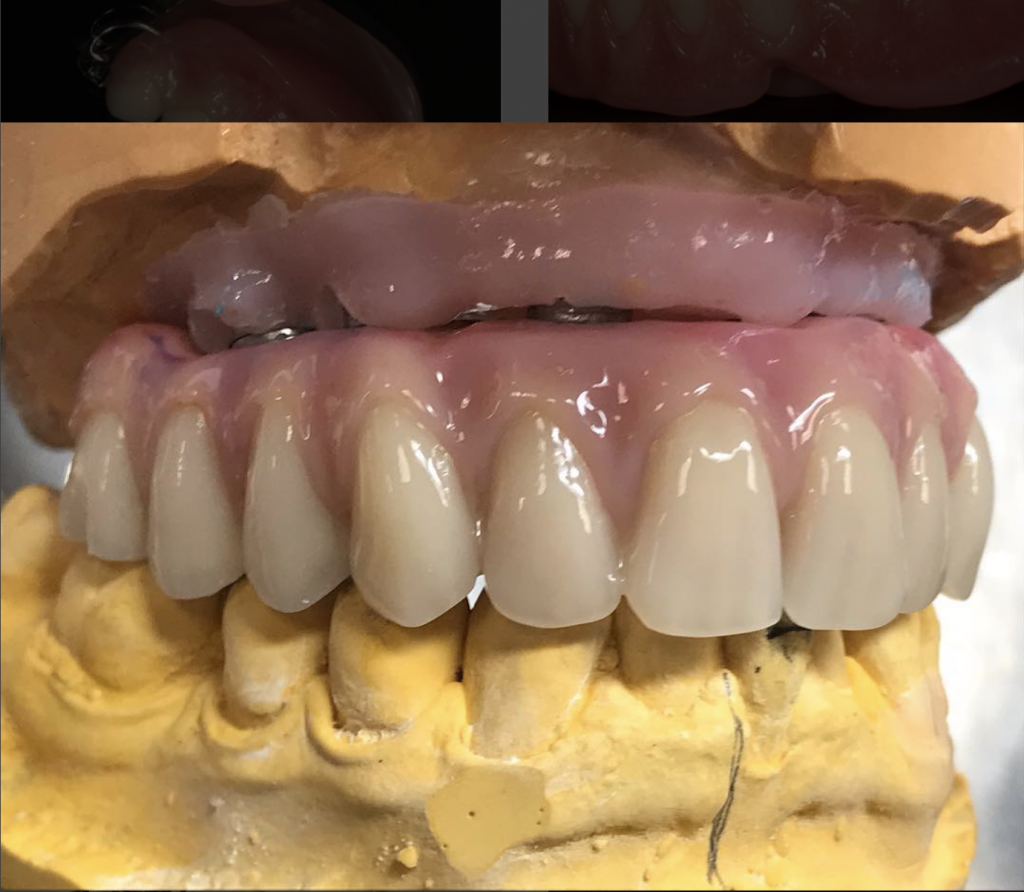 RTDL – Dentures Laboratory